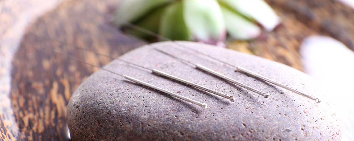 Acupuncture in Portland OR | Call (503) 241‑5094